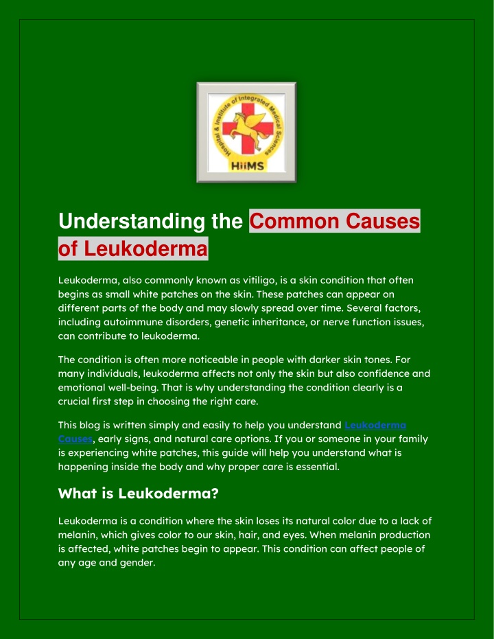 PPT - Understanding the Common Causes of Leukoderma PowerPoint ...