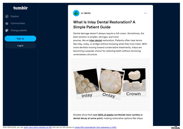 PPT - What Is Inlay Dental Restoration A Simple Patient Guide ...