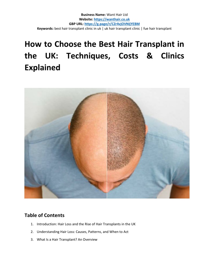 PPT - How to Choose the Best Hair Transplant in the UK: Techniques ...